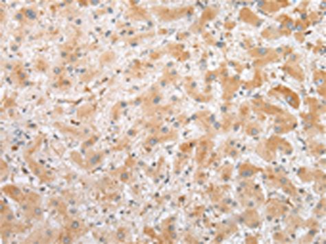 兔抗c1qtnf3多克隆抗体anti C1qtnf3 Rabbit Polyclonal Antibody 生命科学产品与技术服务 生工生物
