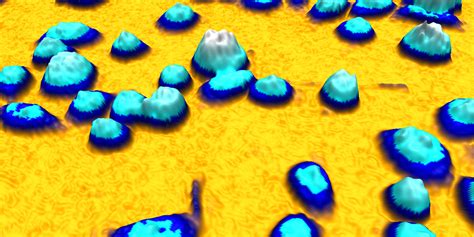 Quantitative Phase Imaging Phi