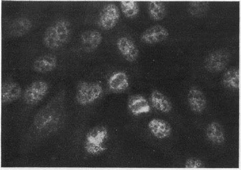 Immunofluorescence Of Hep 2 Cells Serum From A Patient With Arc Download Scientific Diagram