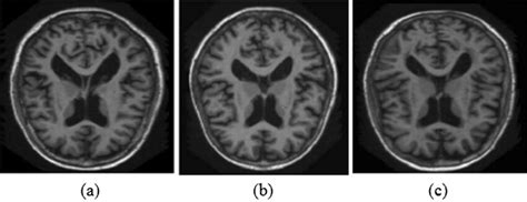 Sample Image Of Oasis Dataset A Normal Control B Mci And C Ad