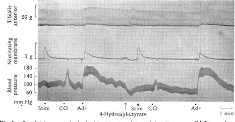 Figure 1 From The Action Of Sodium 4 Hydroxybutyrate On Spinal Reflexes Semantic Scholar