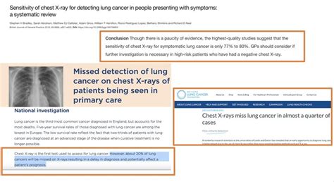 Priya Gupta On Linkedin Chest X Rays Are The Most Commonly Used Type