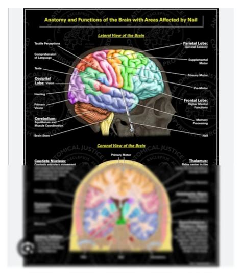 SOLUTION: Brain diagram and functions - Studypool