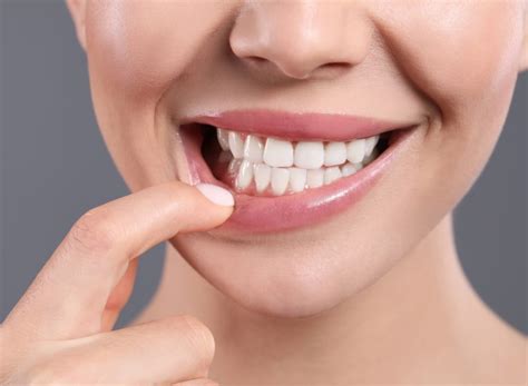 Does Peroxide Whiten Teeth Buyers Report