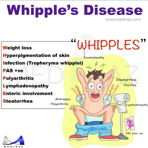 Whipple Disease Biopsy