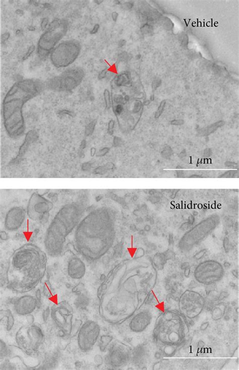 Bafilomycin A1 Blocked Salidroside Induced Autophagic Degradation Of