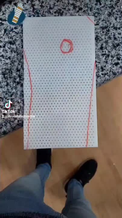 Video Mcp Flexion Splint For Wrist Joint Mostafa Shawky Pt Msc