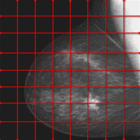 Fpga图像处理 Clahe算法二 知乎