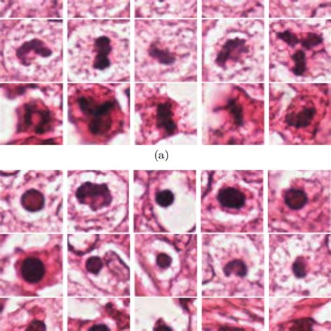 Detection Of Mitotic Cells In Breast Cancer Histopathological Images