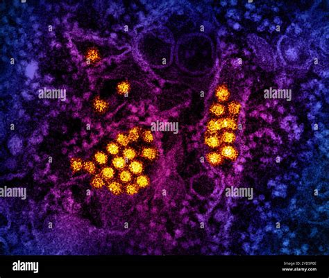 Transmission Electron Micrograph Of Dengue Virus Particles Gold Stock