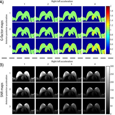 A Transversal Slice Of G Factor Maps With Different Acceleration