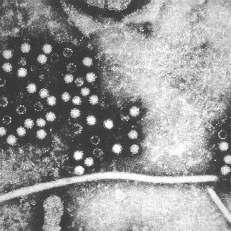 Hepatitis E Virus Igg Antibody Test Near You In Delhi Book Test At