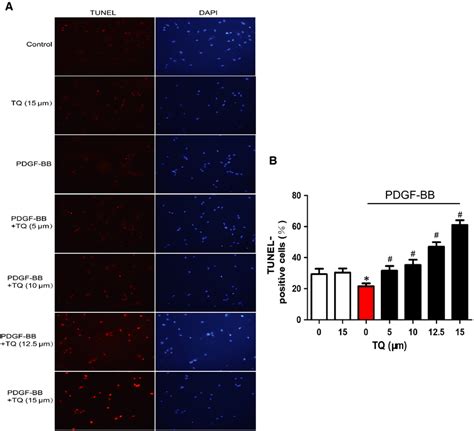 Effects Of Tq On Apoptosis Of Vsmcs Serum‐starved Vsmcs Were