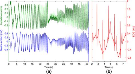 Example Of Skin Electrode Interface Impedance And The Motion Artifact Download High