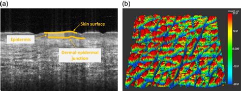 a annotated 2d‐oct scan of the breast skin b 3d surface roughness