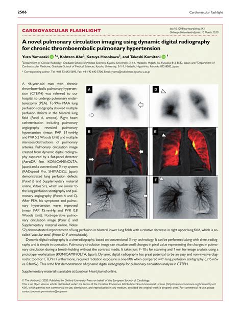 Pdf A Novel Pulmonary Circulation Imaging Using Dynamic Digital Radiography For Chronic