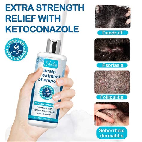 Scalp Treatmentshampoo With 1 Ketoconazole Shampooing For Dry Scalp And Folliculitis Shampoo