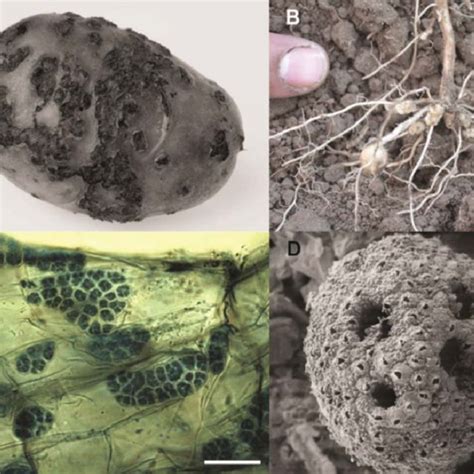 Resting Spores Of Polymyxa Graminis In Poa Sp Resting Spores Are