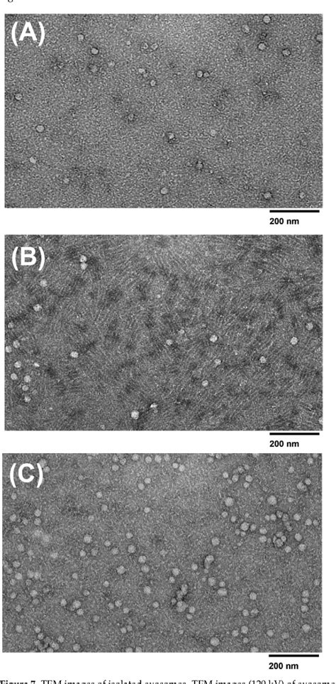 Figure 7 From Development Of A Microfluidic Device For Exosome Isolation In Point Of Care