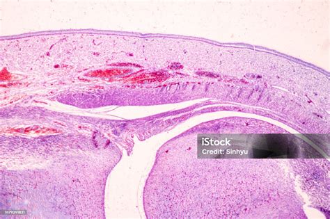 손가락 인간의 피부 조직과 현미경으로 인간의 손톱 발달 손가락 0명에 대한 스톡 사진 및 기타 이미지 0명 건강관리와 의술 곰팡이 Istock