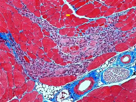 Anas Odeh On Linkedin Deep Learning Image Analysis Service Ive Developed A Python Based Deep