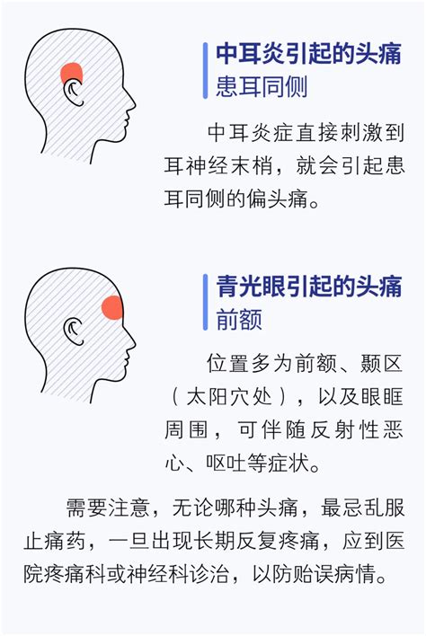 头痛千百种，一图对照查看病因