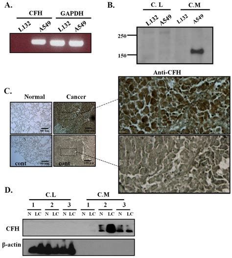Expression Of Complement Factor H Cfh In Lung Cell Lines And Human Download Scientific