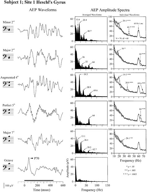 Waveforms And Amplitude Spectra Of Chord Evoked Aeps Recorded At A