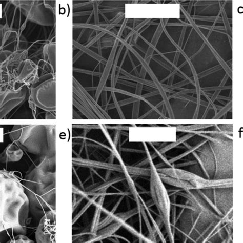 Scanning Electron Micrographs With Scale Bar Indicating 5 µm For