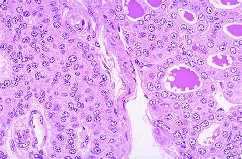 Thyroid And Parathyroid Prepared Slides