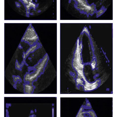 given figure demonstrate the segmentation performance of the proposed