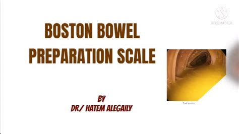 Boston Colon Prep Score Decode Yours For A Better Colonoscopy Answer