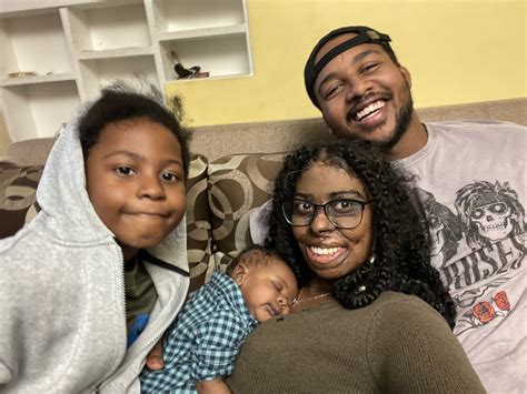 Overcoming Adversity With Burn Survivor Solara Jaafar The Skinny Confidential