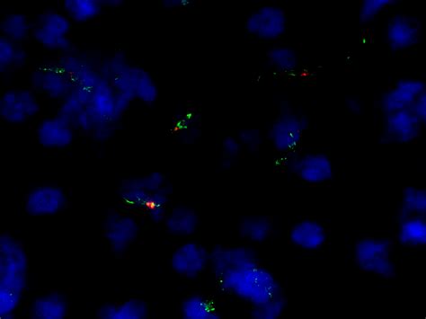 Why Does My Dapi Appear Streaky On Mouse Brain Tissue Researchgate
