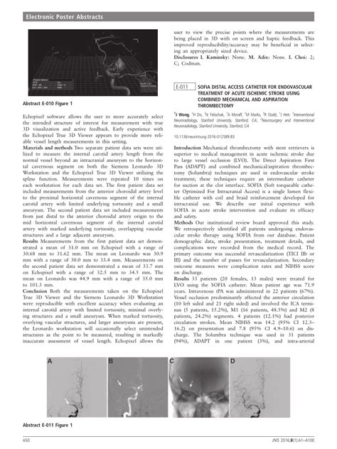 Pdf E 011 Sofia Distal Access Catheter For Endovascular Treatment Of Acute Ischemic Stroke