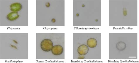 Marine Microalgae Detection In Microscopy Images A New Dataset