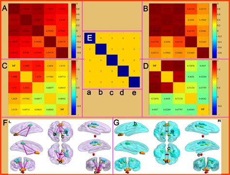 Findings Of Fc Analysis Roi Wise In Five Brain Regions With Altered