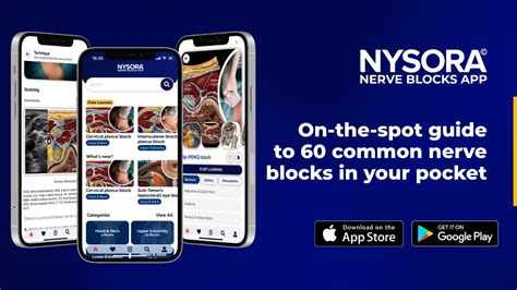 Just Added Intercostobrachial Nerve Block Technique Now Available In Just Added Intercostobrachial Nerve Block Technique Now Available In