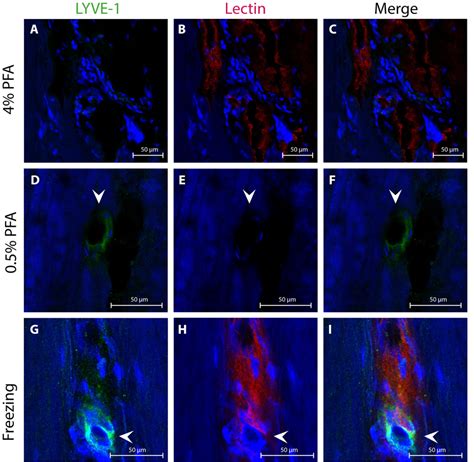 Comparison Between The Three Different Method Groups Top A C Patient Download Scientific