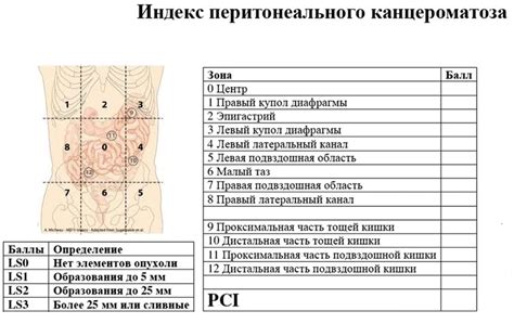 Индекс перитонеального карциноматоза Peritoneal Cancer Index Pci