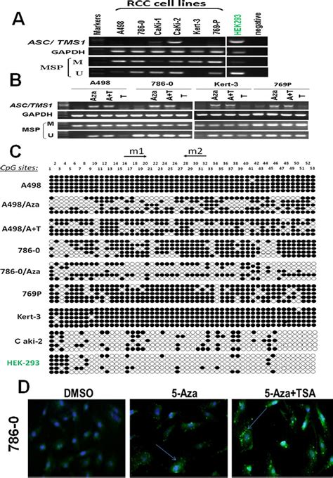 Asc Tms1 Inactivation By Promoter Hypermethylation In Rcc Cell Lines