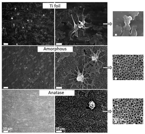 Nanomaterials Free Full Text Crystallized TiO2 Nanosurfaces In Biomedical Applications