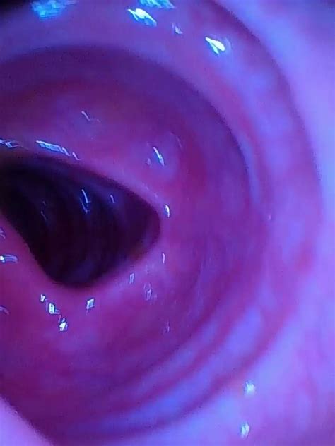 A Colonoscopy For A Female Friend Video 5