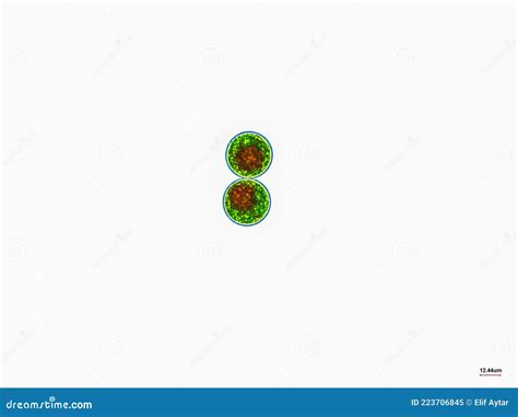 Haematococcus Pluvialis Algae Under Microscopic View Stock Image