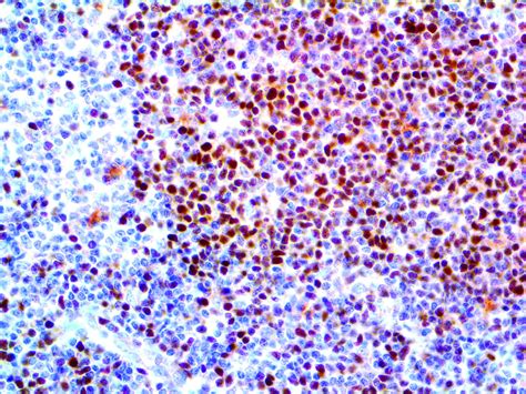 Granzyme B Antibody Ep230 Bio Sb