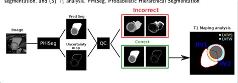 Automated Quantification Of Myocardial Tissue Characteristics From Native T1 Mapping Using