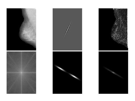 Detection Of Architectural Distortion In Prior Mammograms Via Analysis