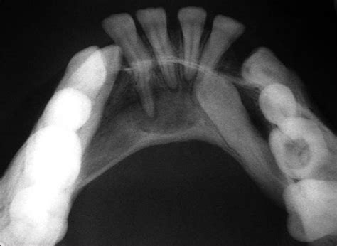Occlusal Radiograph 1 Buyxraysonline