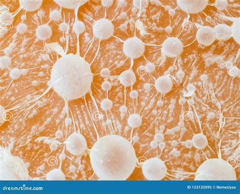Cancer Tumour Macro Photo Stock Image Image Of Illness 123132095