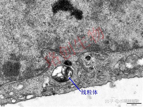 第三十期：透射电镜下的线粒体自噬 知乎